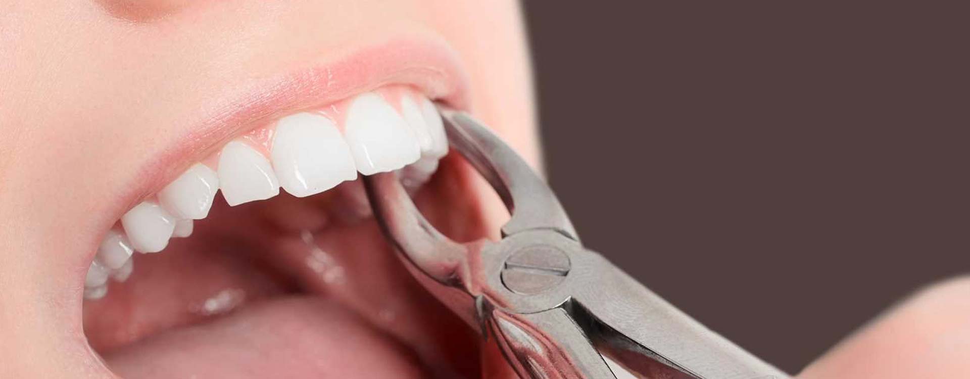 Painless Teeth Removal | Teeth Removal Dentist Near Me | Dentalign